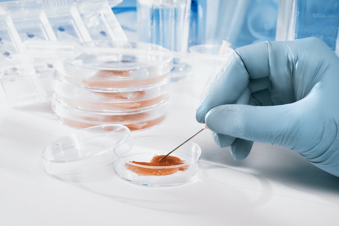 ISO 22196 Measurement of antibacterial activity on plastics and other ...