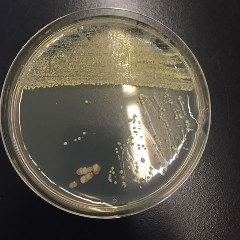 MESOPHILIC AEROBIC BACTERIA ANALYSIS